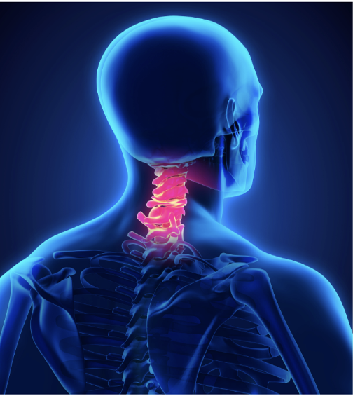 Spinal Cord Injury Attorneys - D'Amore Personal Injury Law, LLC Spinal Cord Injury Attorneys - D'Amore Personal Injury Law, LLC
